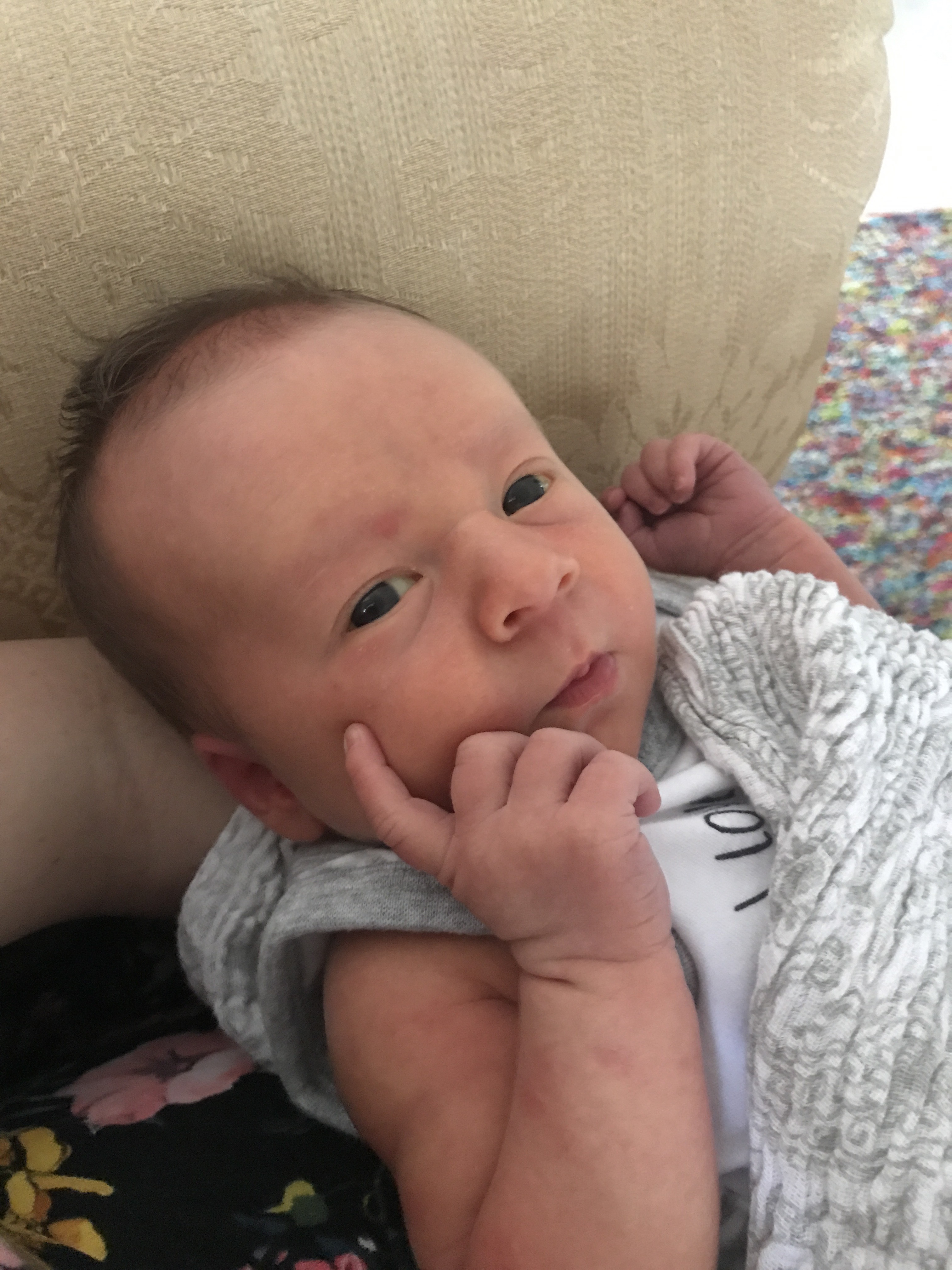 Patient Gallery – Dr Vincent Loh